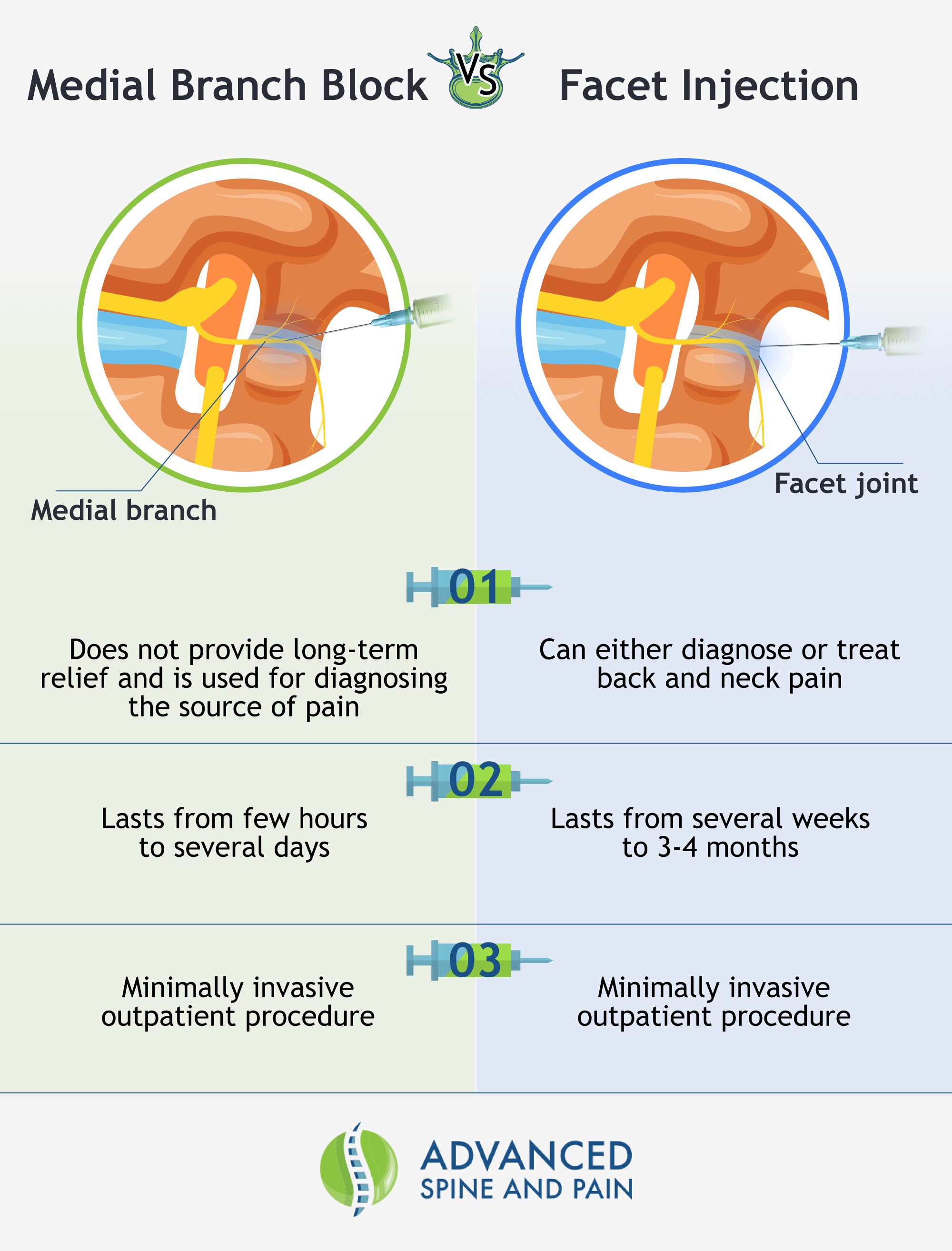Medial Branch Block vs. Facet Injection | Advanced Spine and Pain